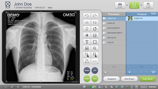 Easy-to-read GUI designs were made to be suitable for the environment ...