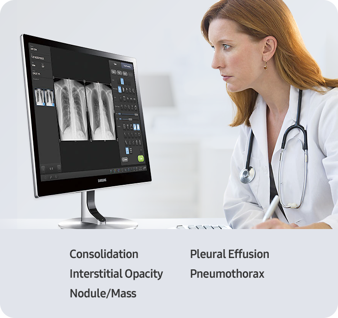 CAD solution with VUNO Med®-Chest X-ray™