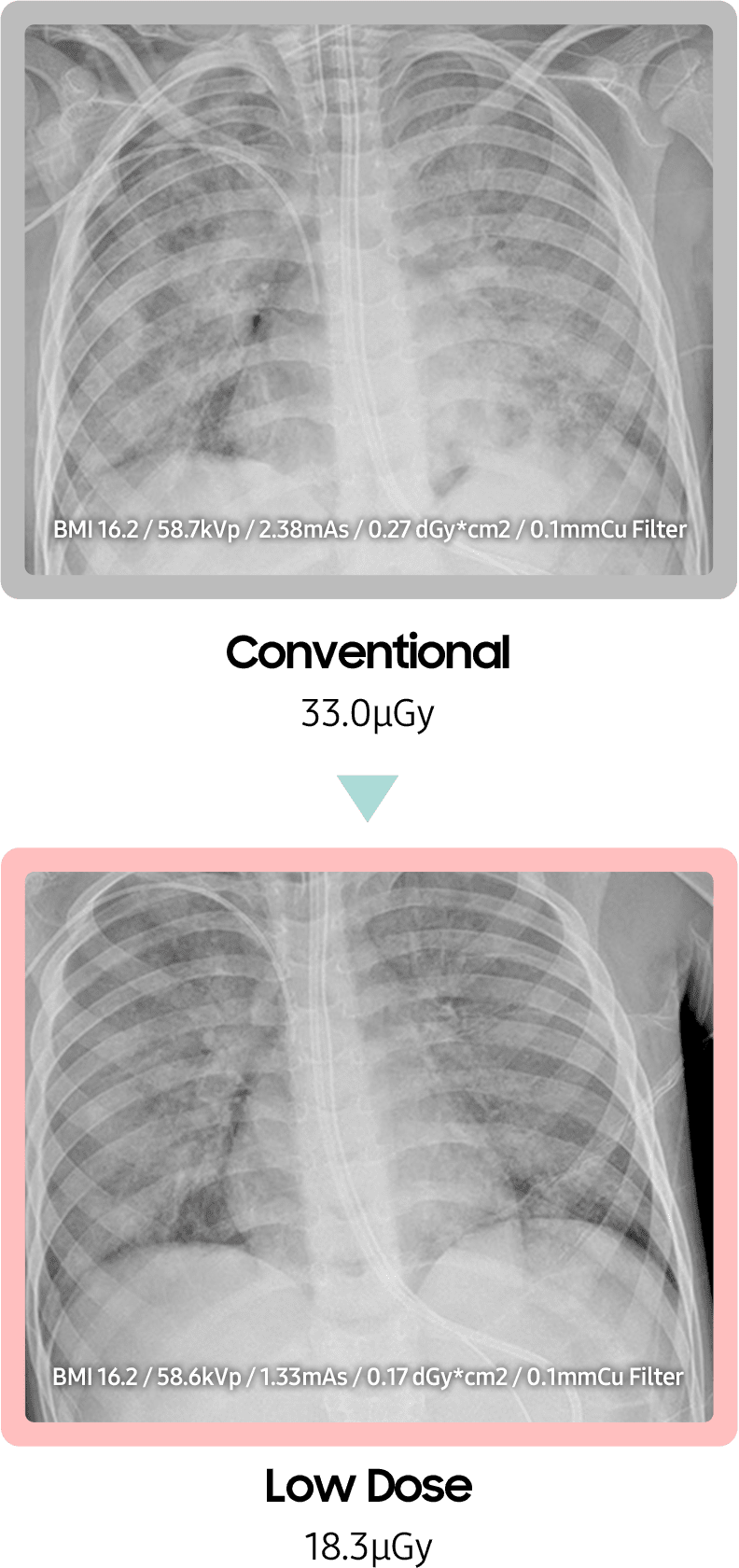 * The claim concerning Samsung DR is based on limited phantom and ...