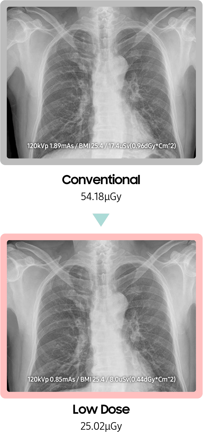 * The claim concerning Samsung DR is based on limited phantom and ...