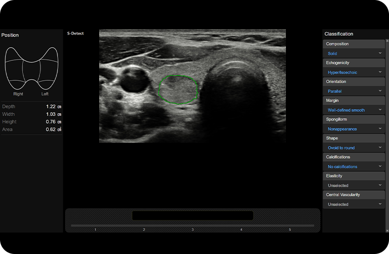 * ATA: American Thyroid Association
